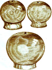 The Pirate Surgeon's Journal: Golden Age of Piracy: Cupping Therapy Page 1