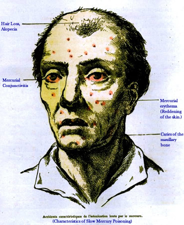 The Pirate Surgeon's Journal: Golden Age of Piracy: Venereal Diseases ...